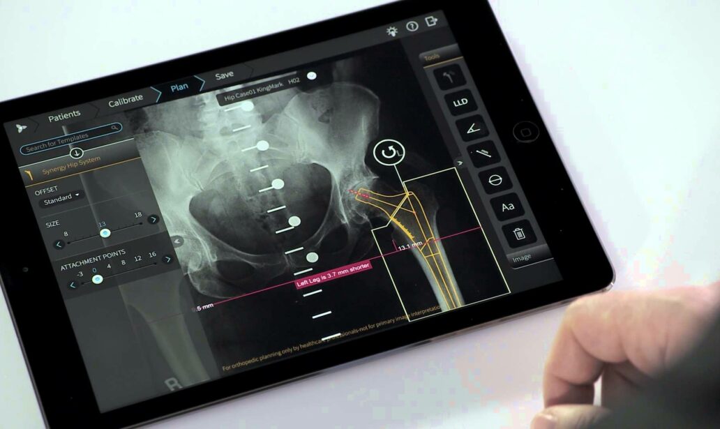 App helps orthopedic surgeons plan procedures – ApplySci