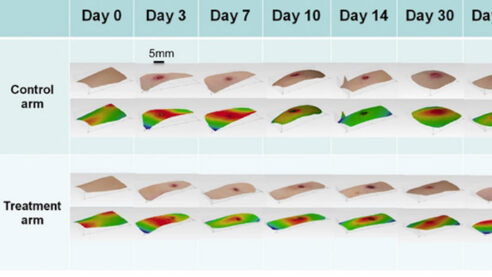 Electrical stimulation to accelerate wound healing – ApplySci – Deep ...