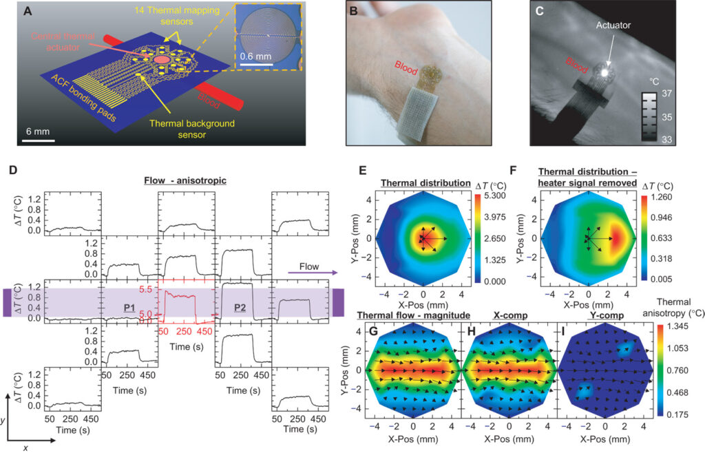 Continuous blood flow measuring wearable – ApplySci – Deep Tech Health ...