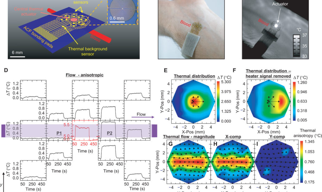 Continuous blood flow measuring wearable – ApplySci