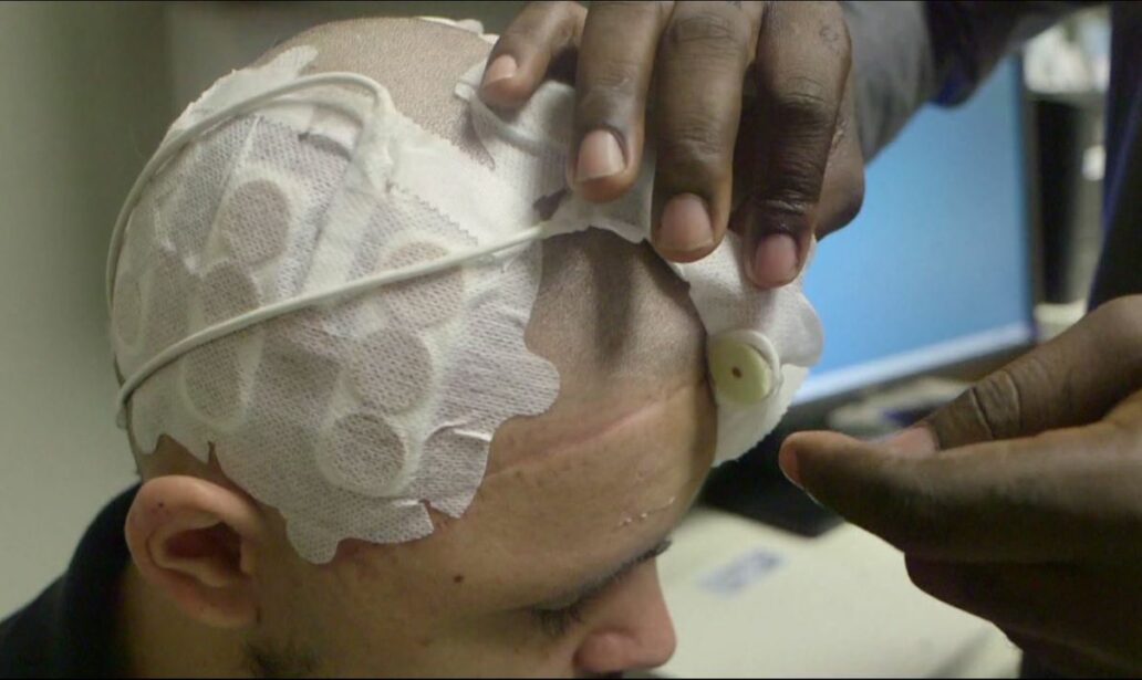 Non-invasive electric field treatment for glioblastoma – ApplySci