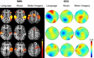 fMRI + EEG used to detect consciousness in ICU patients – ApplySci ...