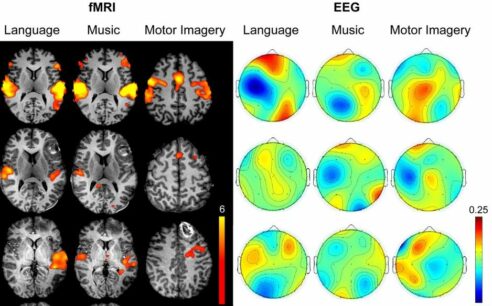 fMRI + EEG used to detect consciousness in ICU patients – ApplySci ...