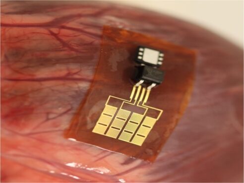Ingestible, flexible sensor to diagnose gastrointestinal disorders ...