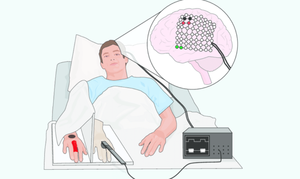 TMS + VR for sensory, motor skill recovery after stroke – ApplySci