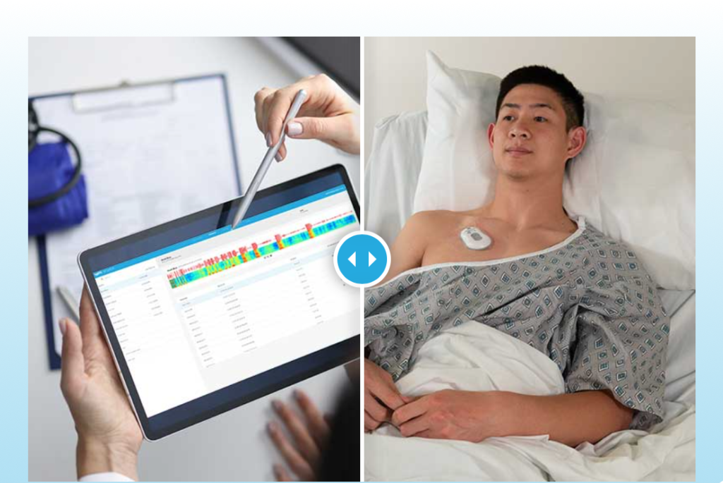 Chest sensor detects worsening asthma, respiratory disease – ApplySci ...