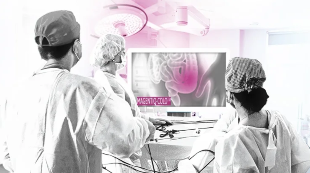 AI-based device increases ademona detection during colonoscopy ...